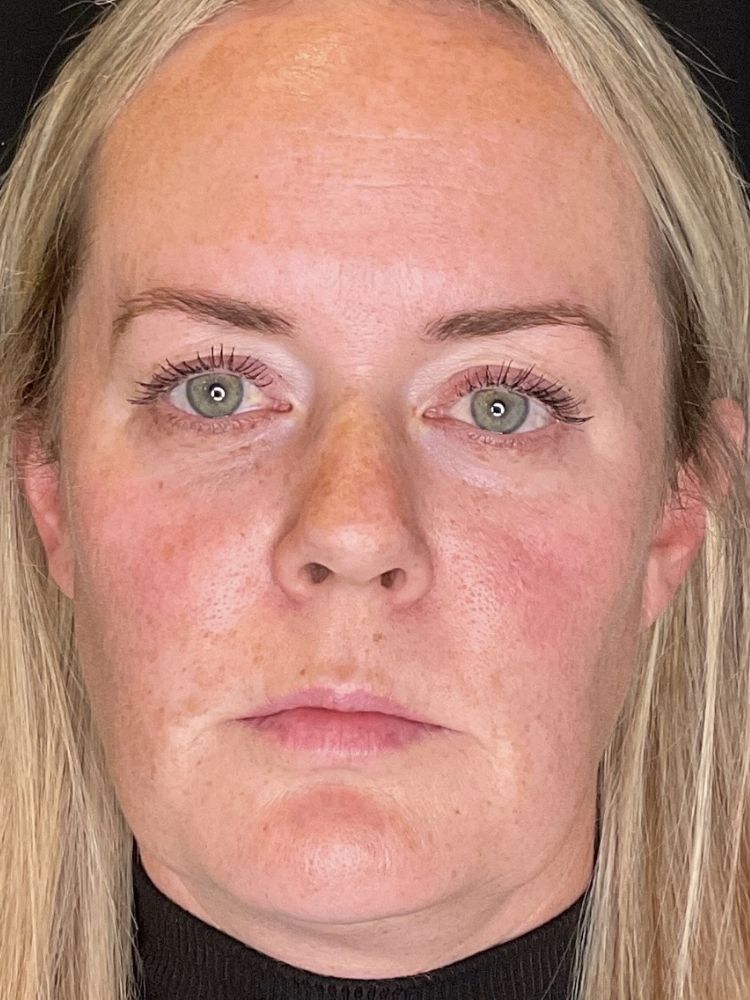 Case #6156 - Bonaldi Aesthetics